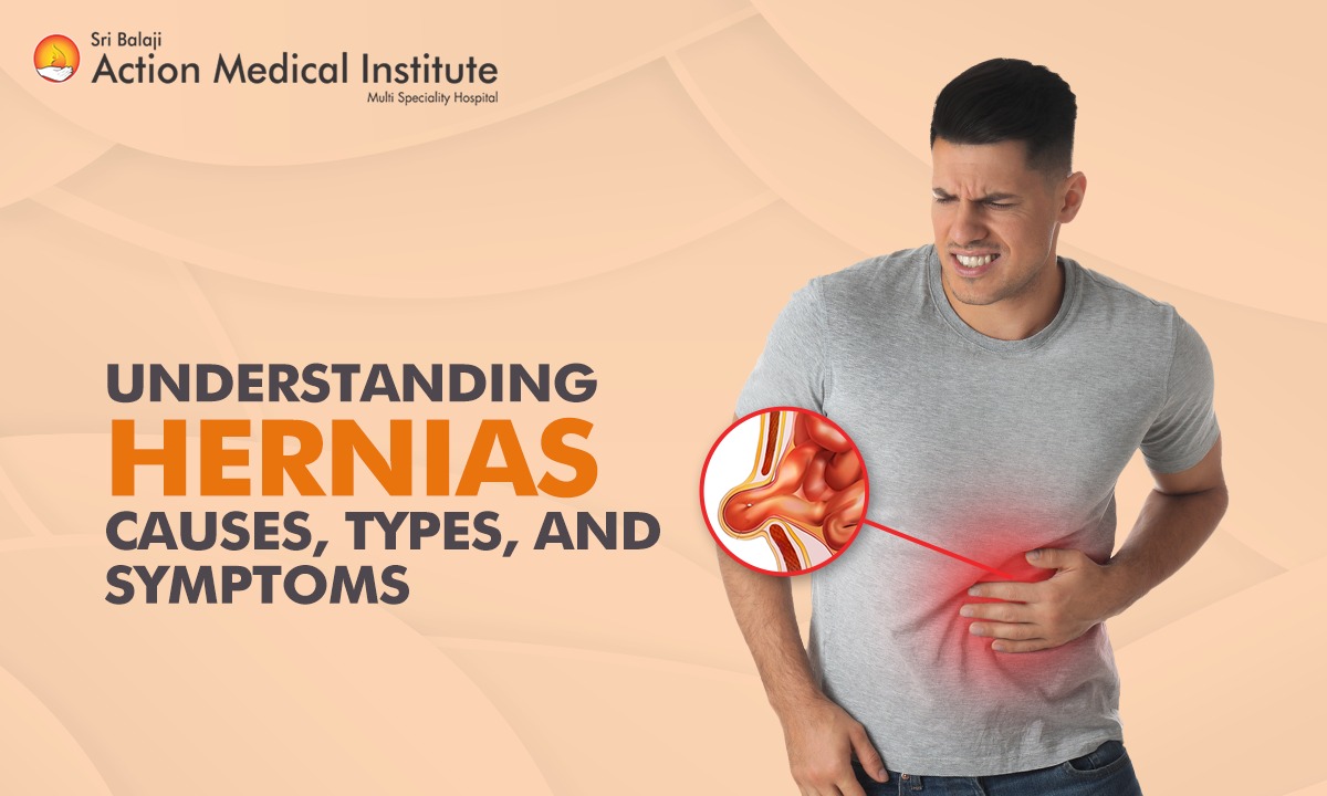 Can Stress Cause A Hernia - EMSEKFLOL.COM